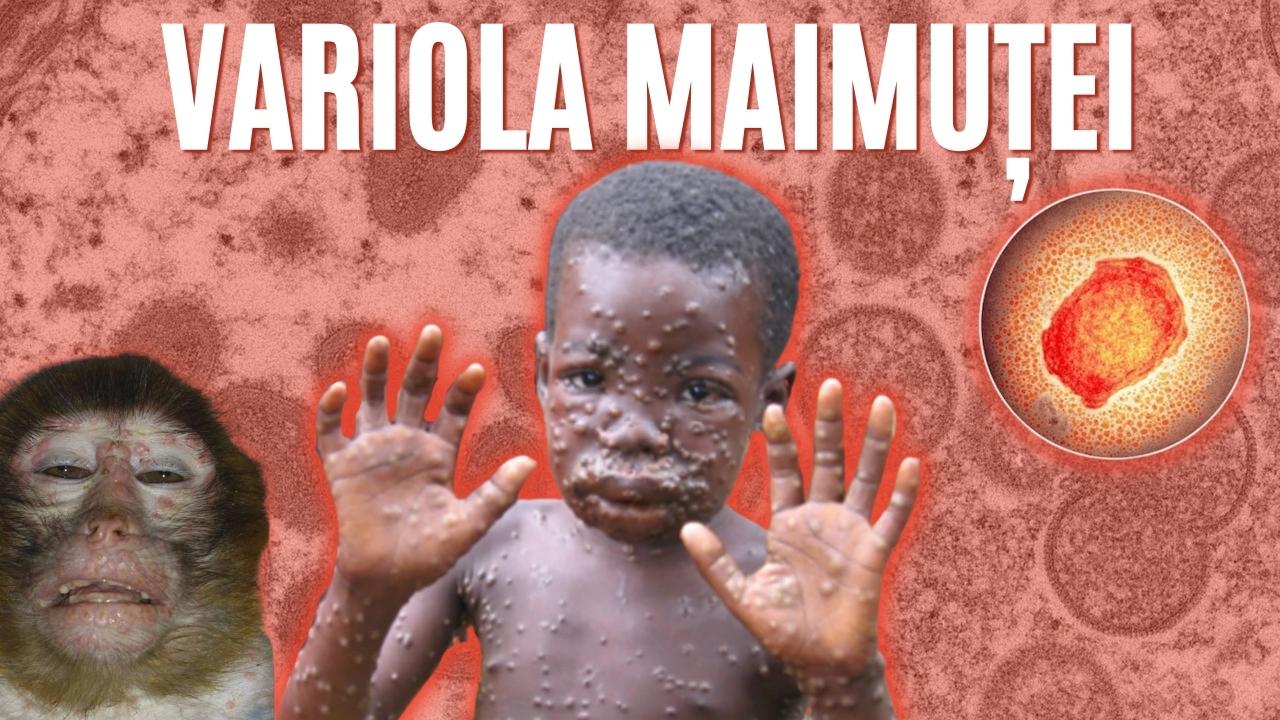 O nouă PANDEMIE? Ce știm despre VARIOLA MAIMUTEI? – Brainium