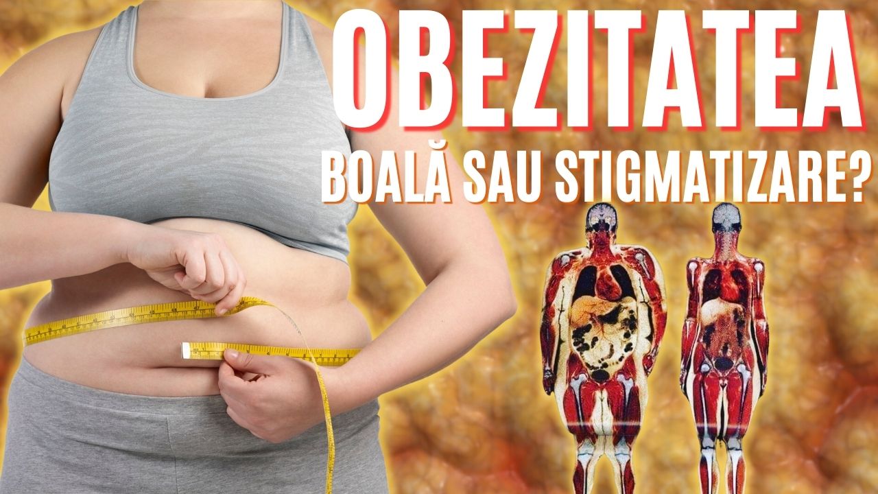 Adevărul despre OBEZITATE | Boală sau stigmatizare? | Cauze, riscuri ...